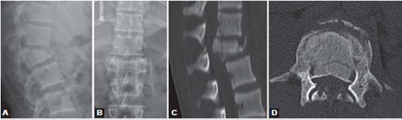 Spine Specialist in Nagarabhavi | Best Spine Clinic in Nagarabhavi